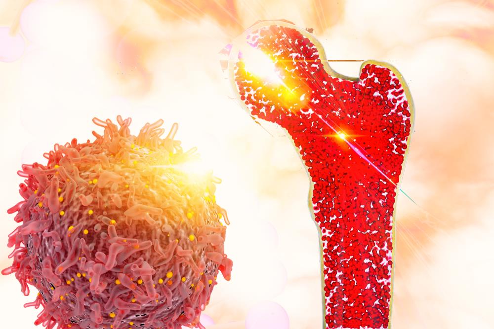 Prvi simptomi raka kostiju: Ove grupe ljudi imaju najveći faktor rizika ...