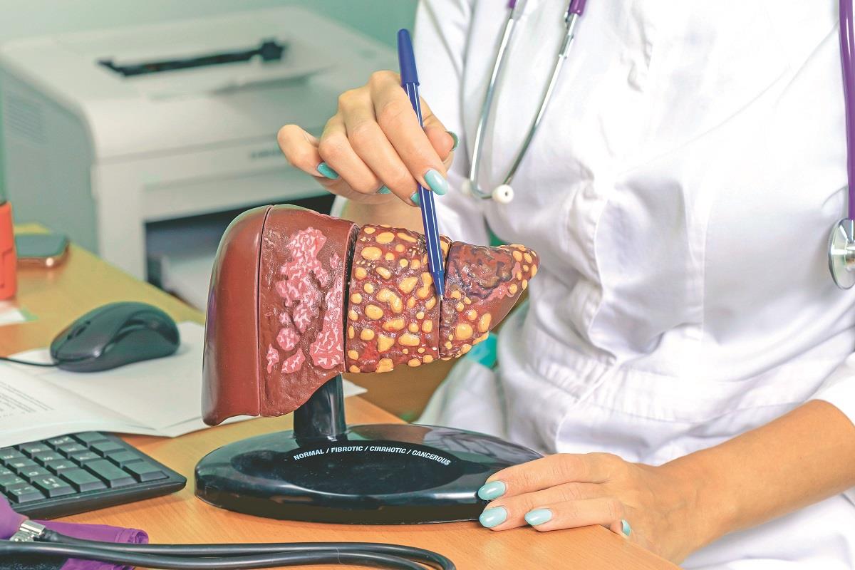 7 dnevni jelovnik za masnu jetru | Stil