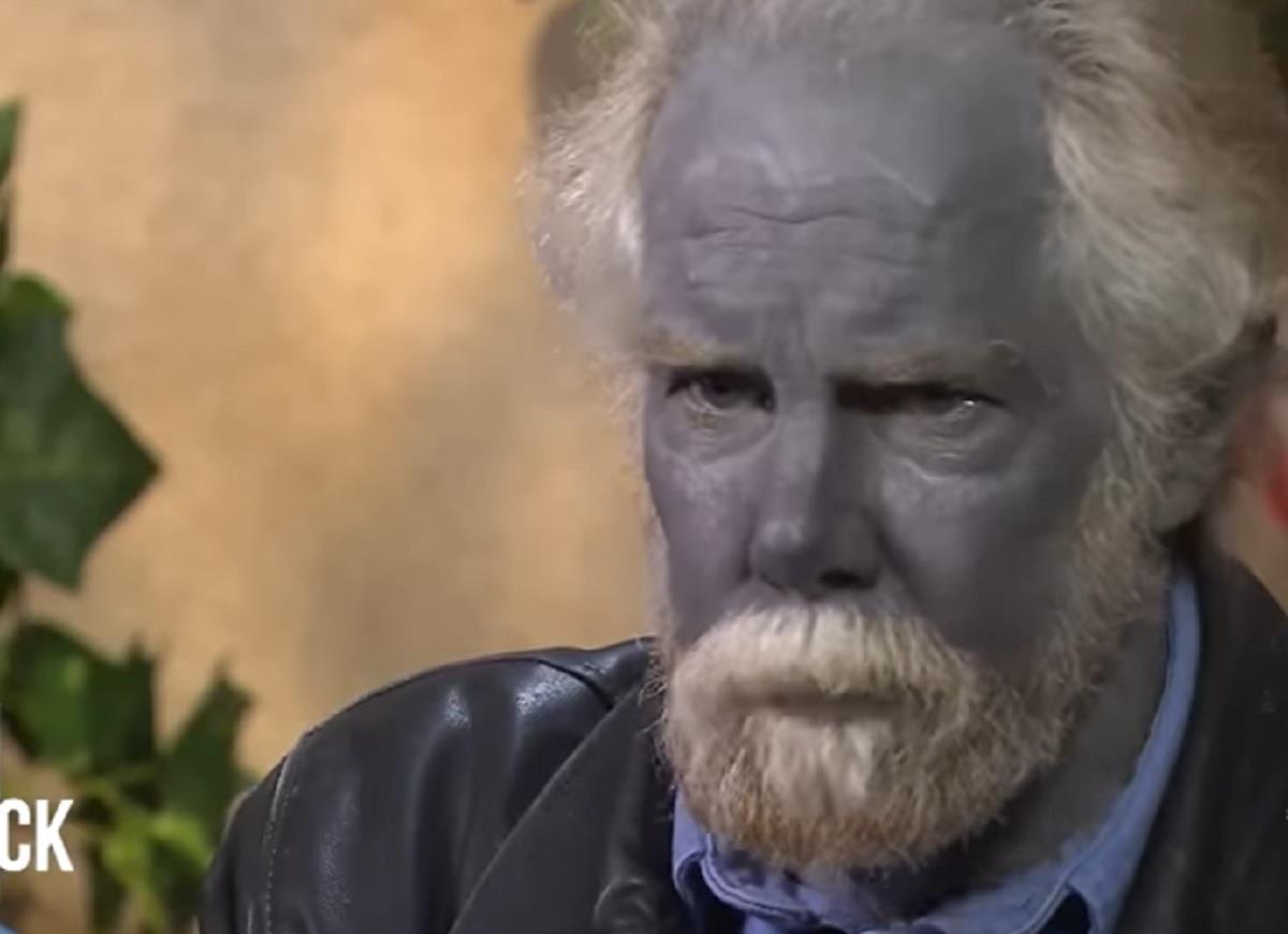 Kako je živeo čovek sa plavom kožom? | Stil