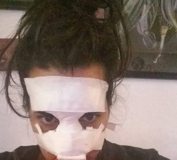 Ćerki Nade Blam udvarač polomio nos | Stil