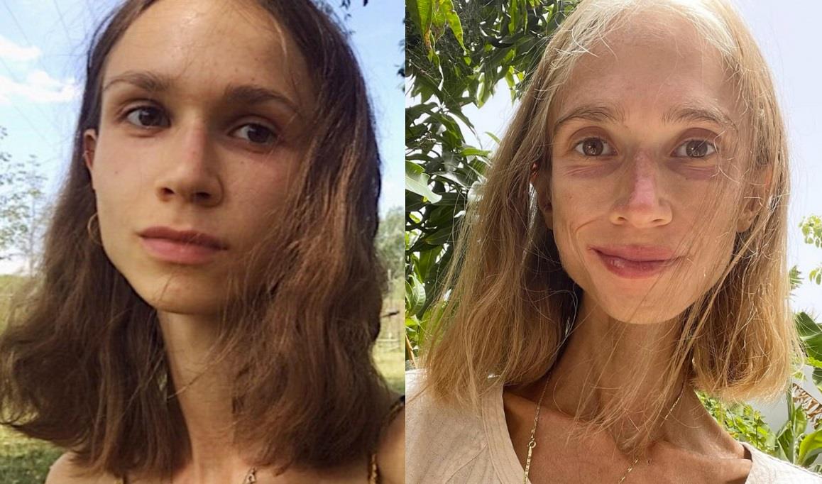 Kako je umrla devojka koja je jela samo voće? | Stil