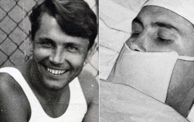 Kako je živeo doktor koji je operisao sam sebe izvadivši slepo crevo | Stil